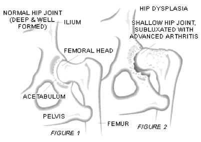 Canine Hip Dysplasia: Symptoms, Diagnosis, Treatment and Prevention